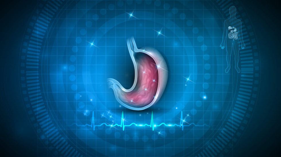 Early Signs Of Stomach Cancer - Comparisonsmaster