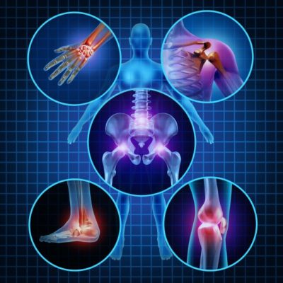 3 Common Types of Arthritis - Main Differences - Comparisonsmaster