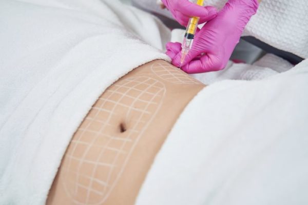 Fat Dissolving Injection: Does It Work? - Comparisonsmaster