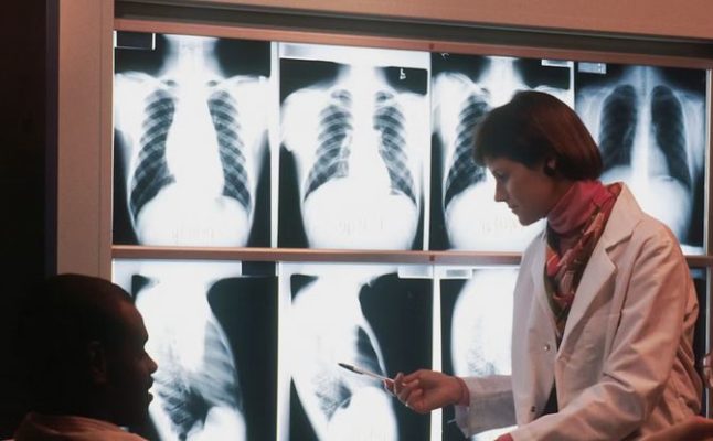 Human Radiologist Offer Accurate Interpretation Of Chest X-Rays ...